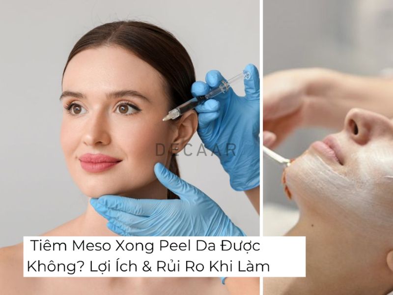 Tiêm Meso Xong Peel Da Được Không? Lợi Ích & Rủi Ro Khi Làm